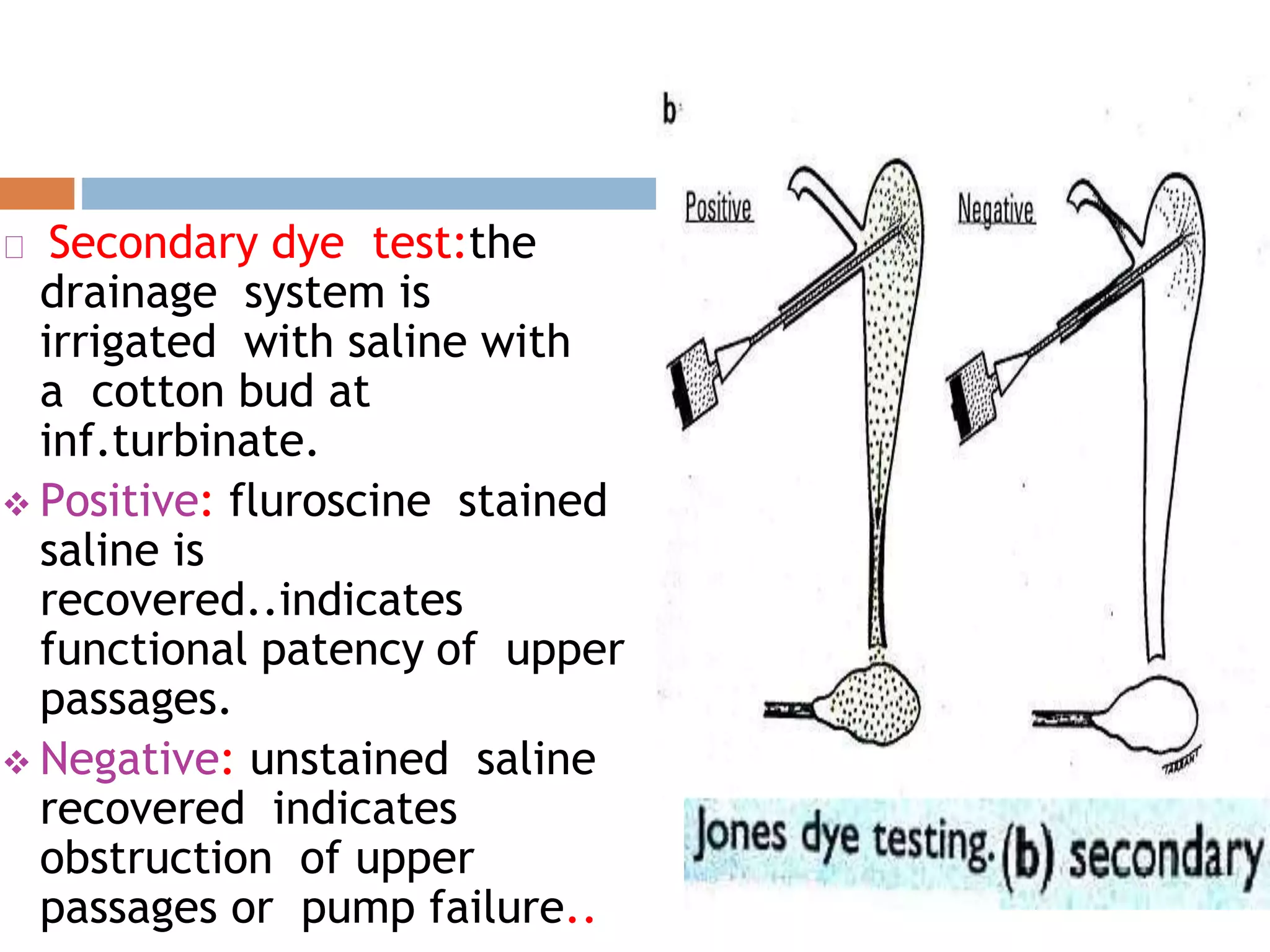 Endoscopic DCR | PPTX