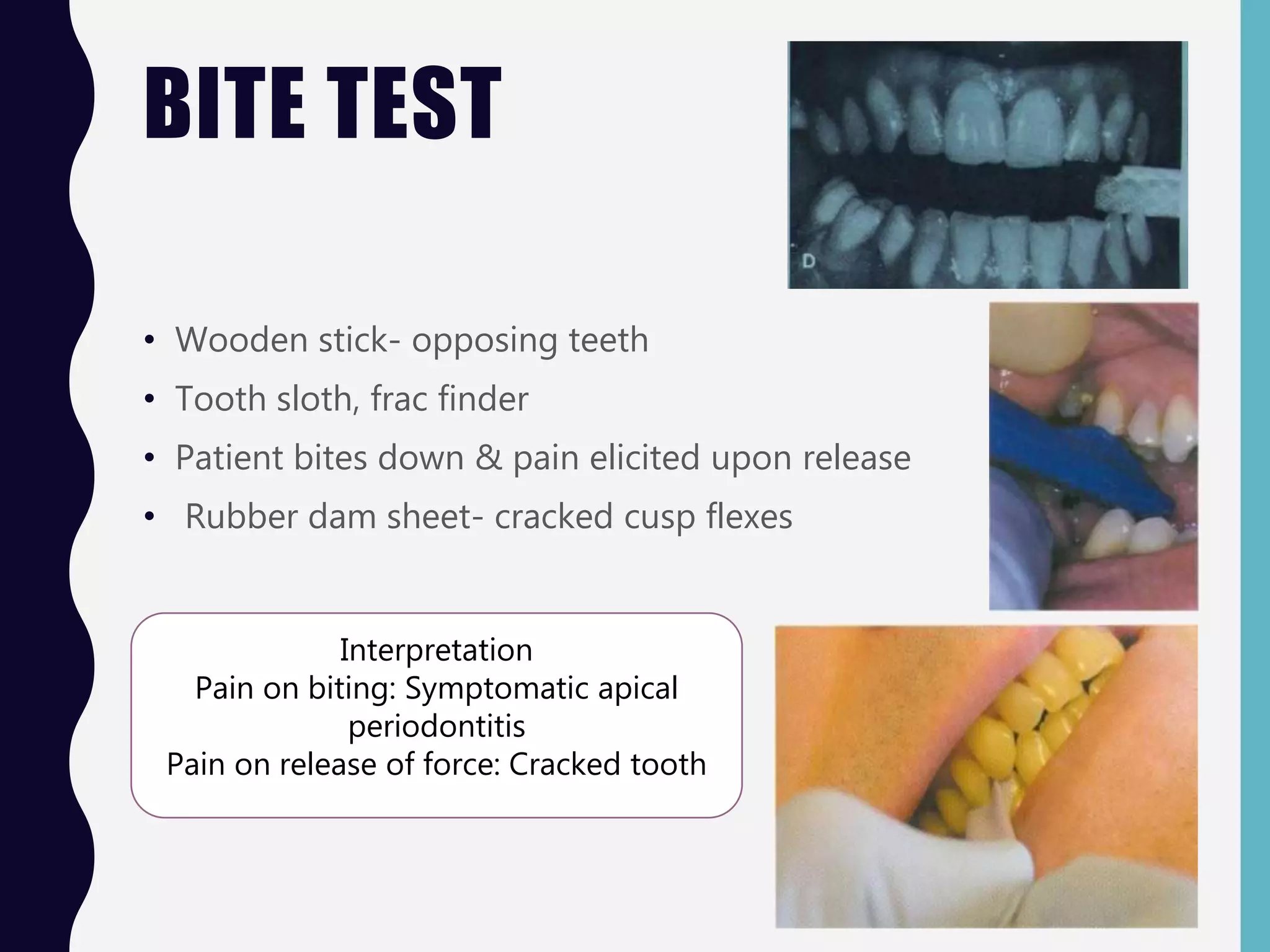 Endo diagnosis | PPTX