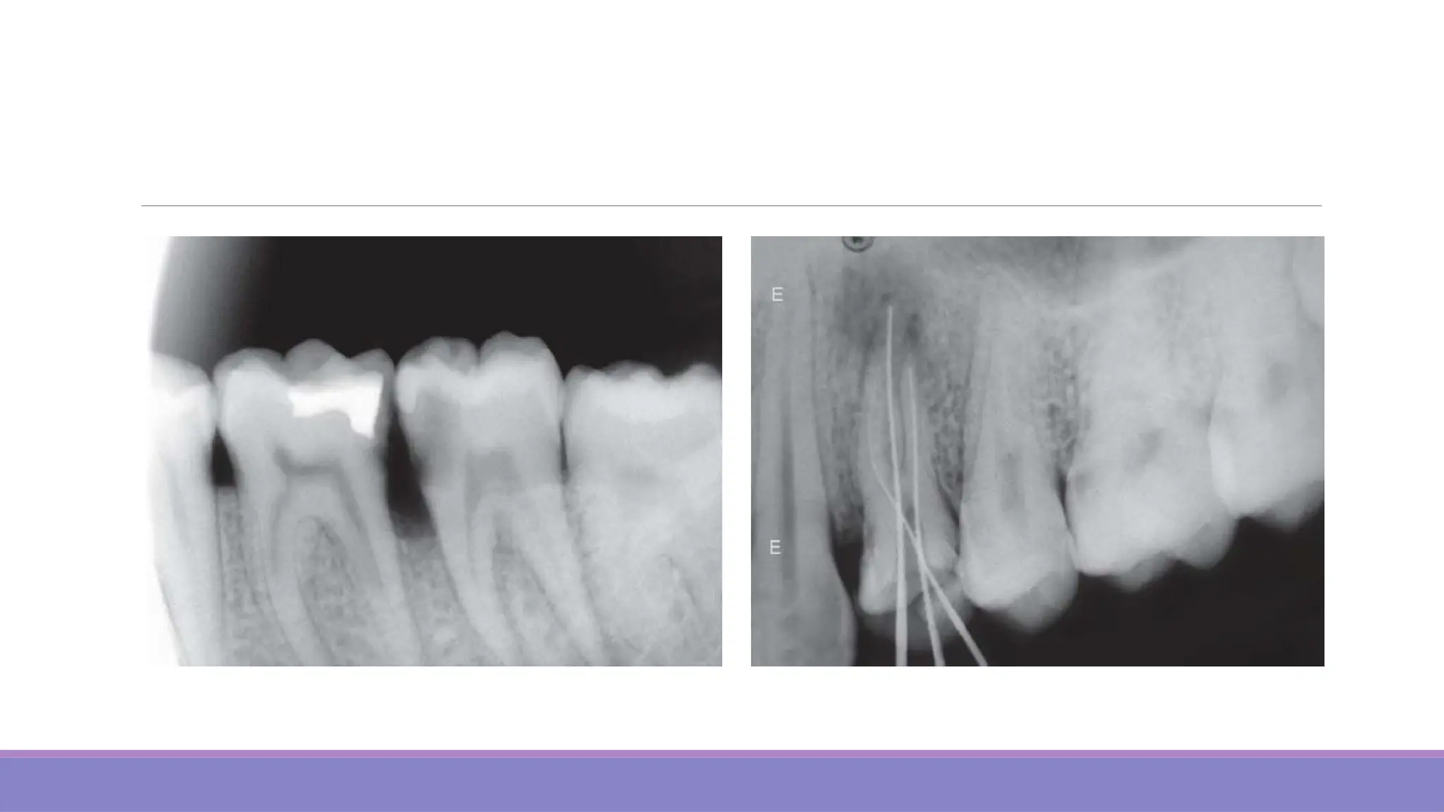 ENDOdontics clinical DIAGNOSIS NEW.pptx
