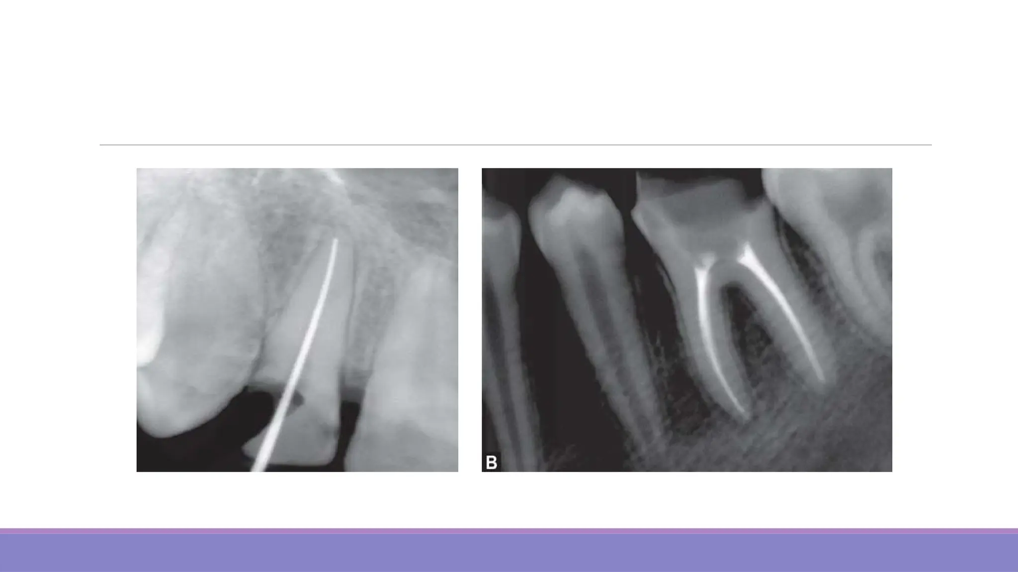 ENDOdontics clinical DIAGNOSIS NEW.pptx