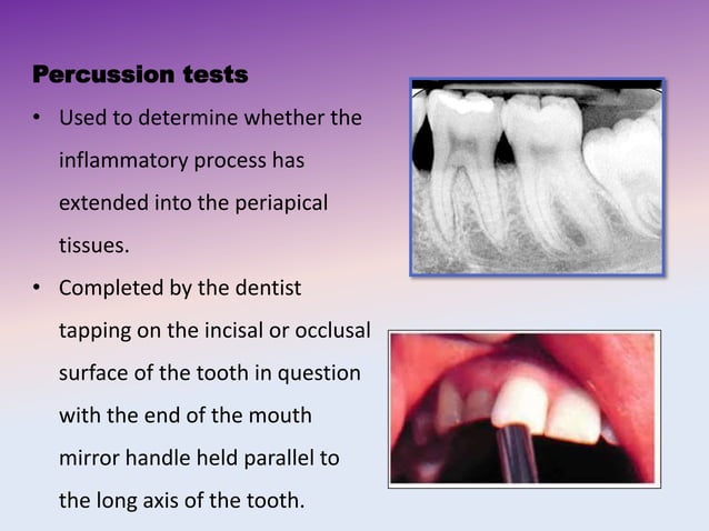 endo diagnosis ppt friday.pptx [Autosaved].pptx