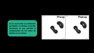 Endodoncia 1.pptx