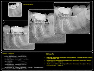 Endodoncia 36 (II) | KEY