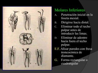 Endodoncia. Introducción a la Anatomía Pulpar y Accesos | PPTX