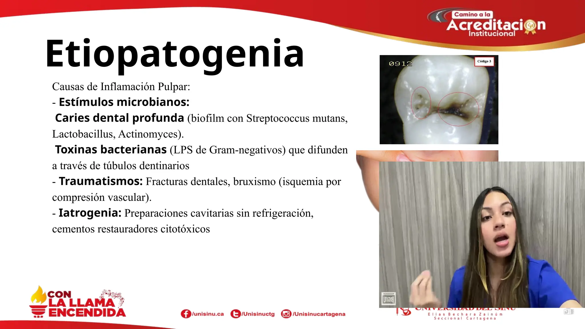 Endodoncia inflamación y necrosis pulpar.pptx