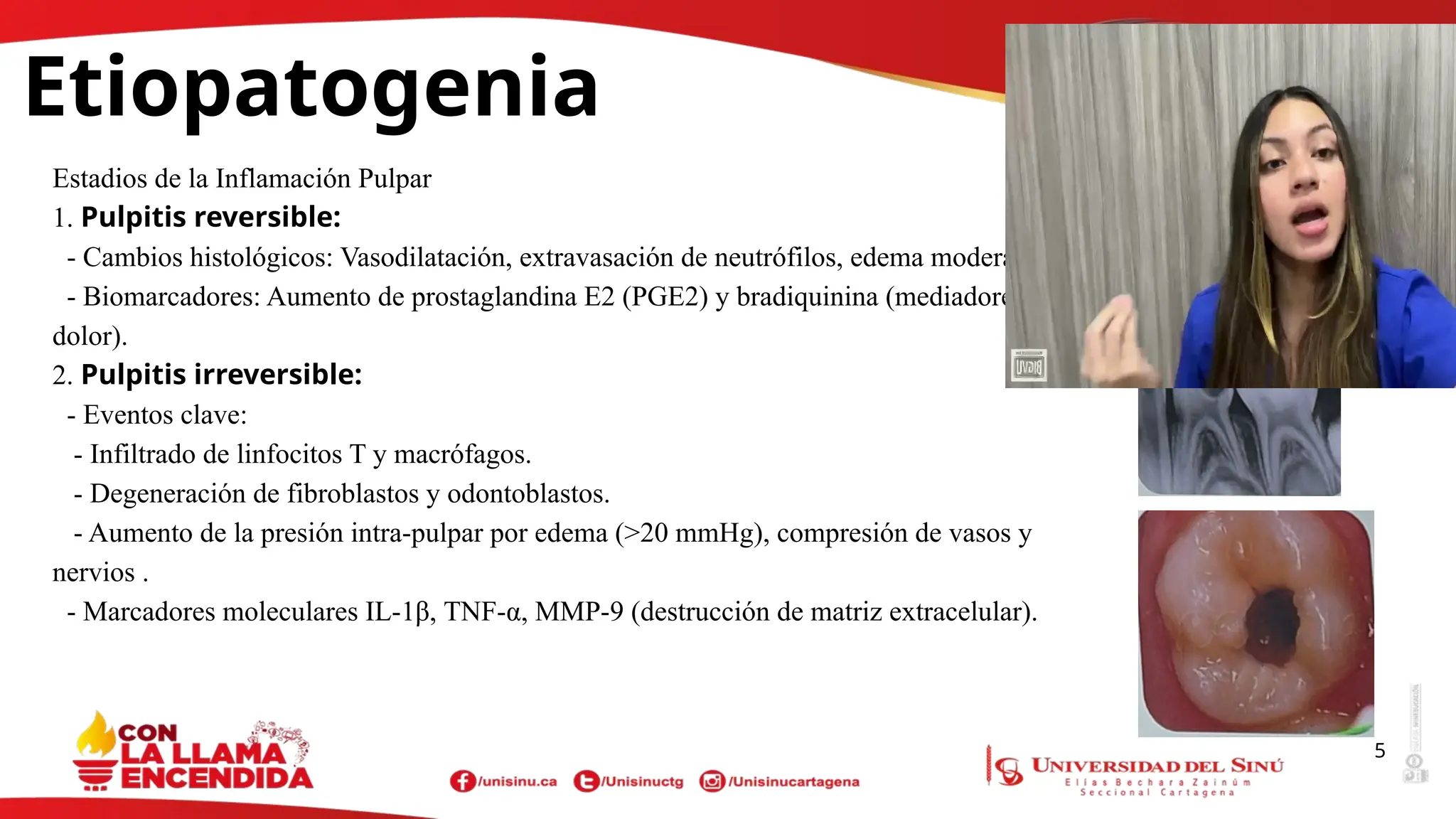 Endodoncia inflamación y necrosis pulpar.pptx