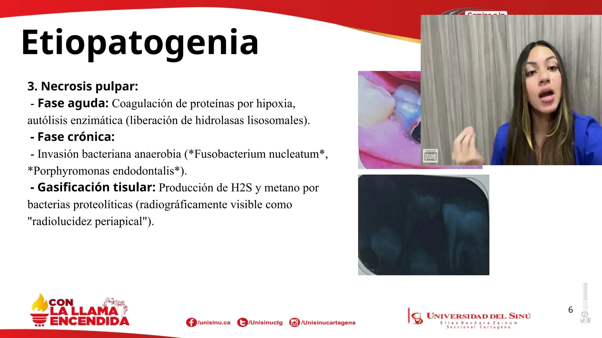 Endodoncia inflamación y necrosis pulpar.pptx