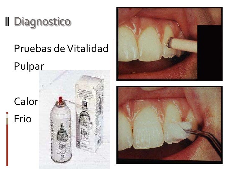 Endodoncia nueva presentacion
