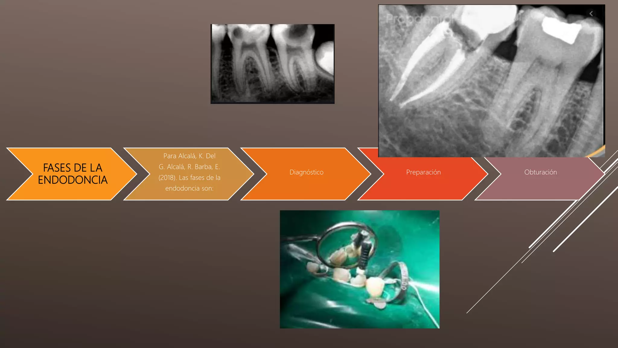ENDODONCIA patología pulpar.pptx