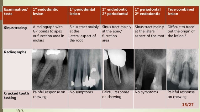 Endodontic periodontal interactions