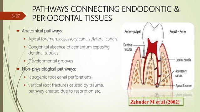 Endodontic periodontal interactions | PPTX