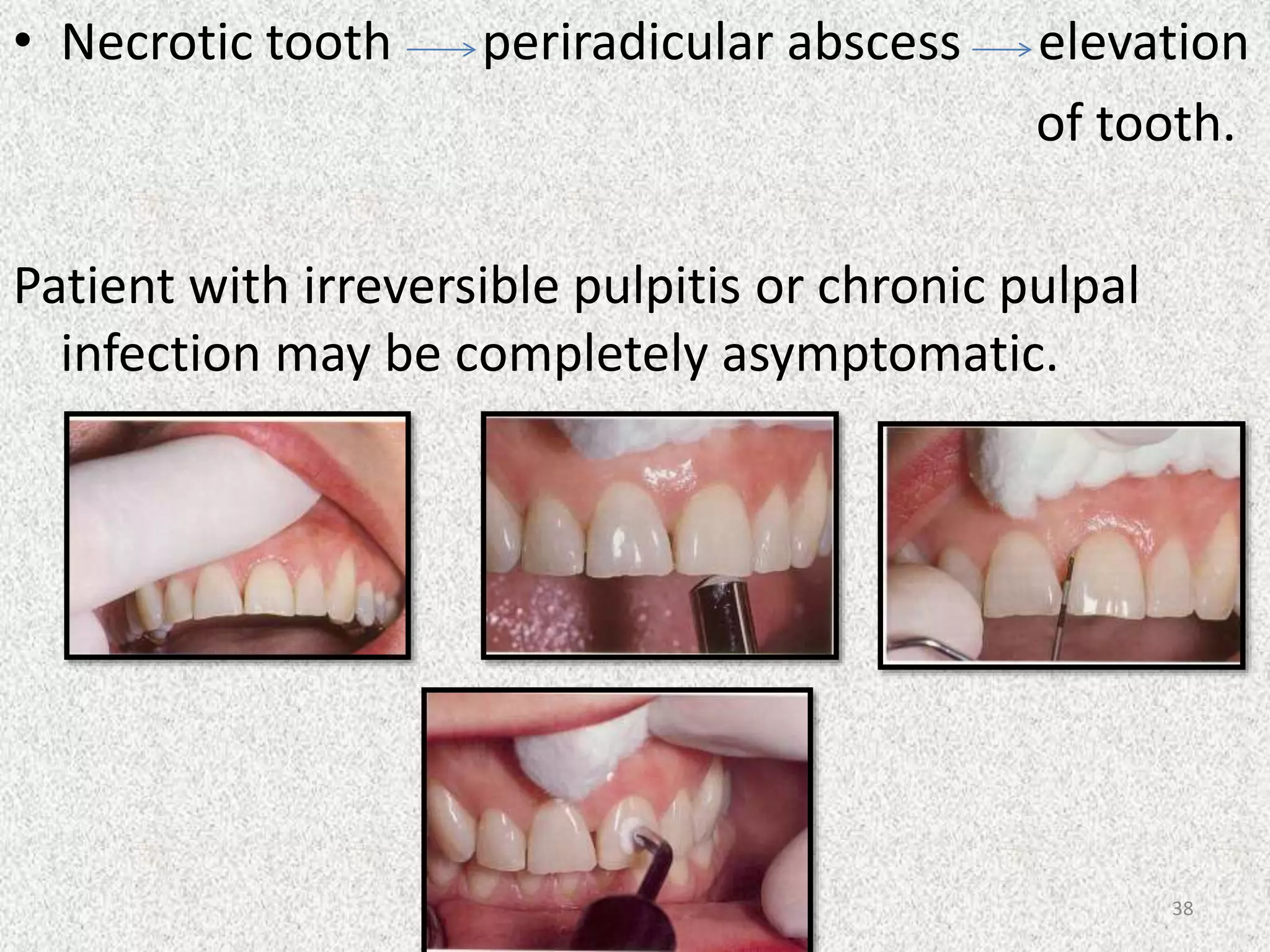 Endodontic periodontic interrelationship | PPTX