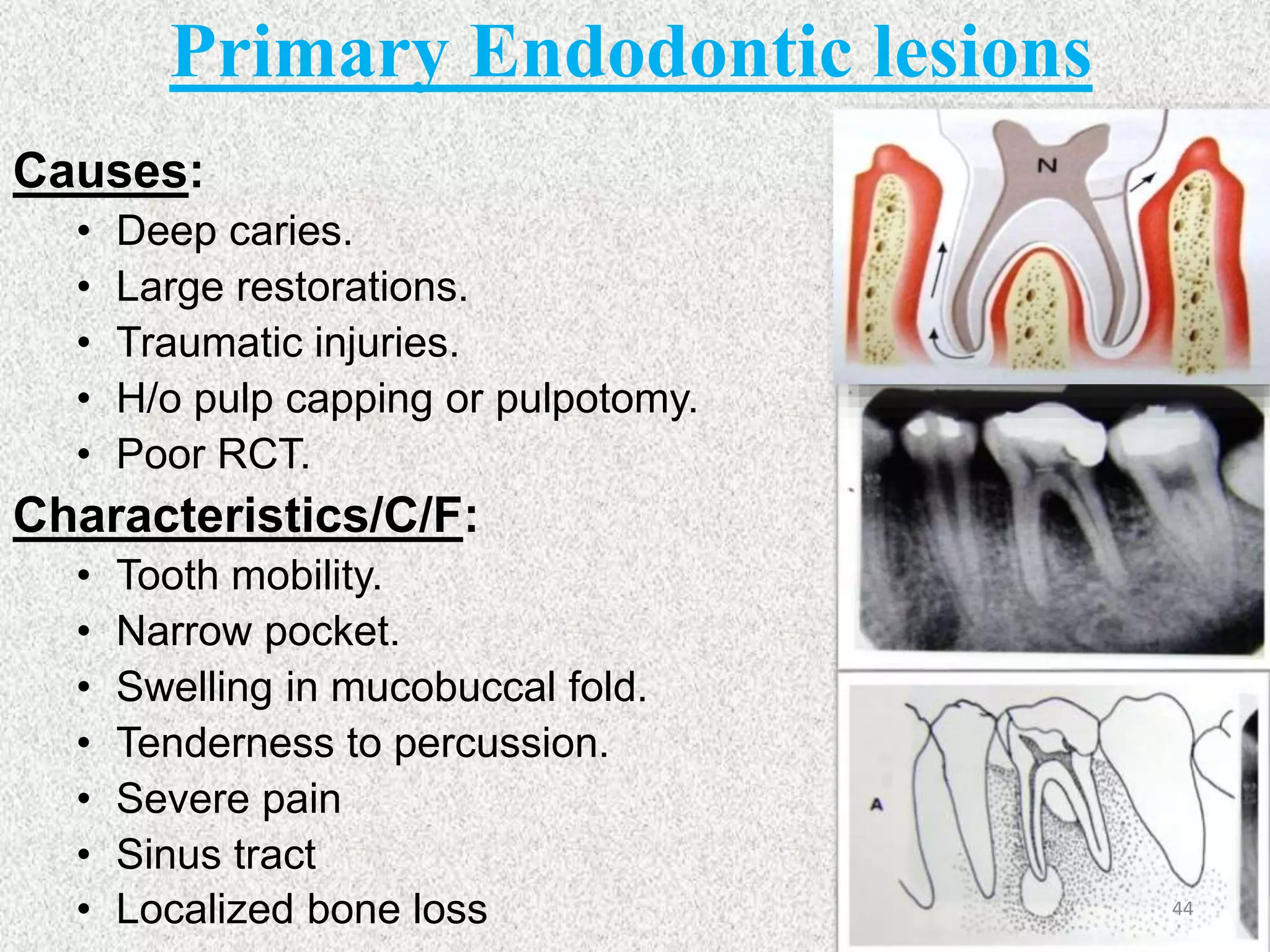 Endodontic periodontic interrelationship | PPTX