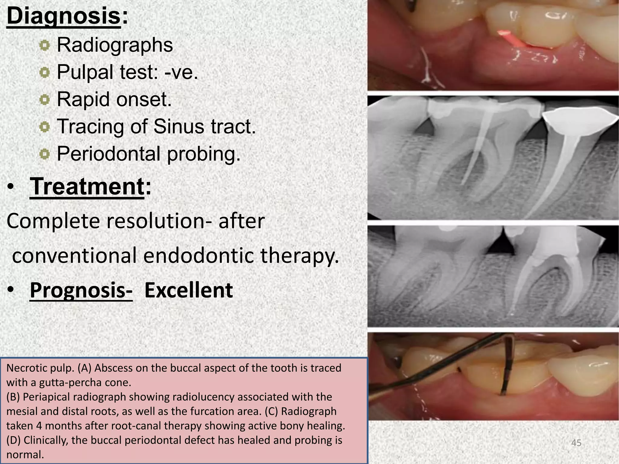 Endodontic periodontic interrelationship | PPTX