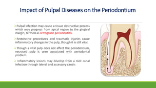 Endodontic-Periodontic Lesions-ediated.pptx