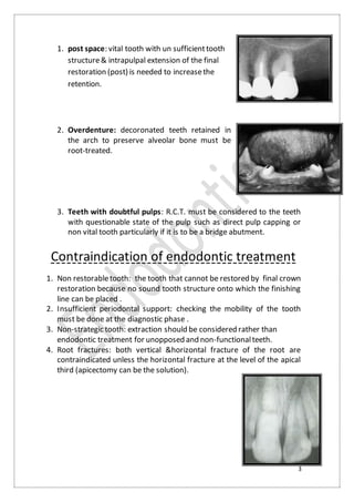 K-Endodontic scope-lec-1 | DOCX | Dental Health | Diseases and Conditions