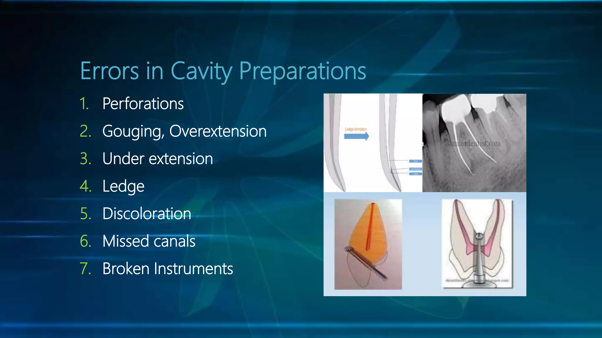 Endodontic Access Cavity Preparation | PPTX