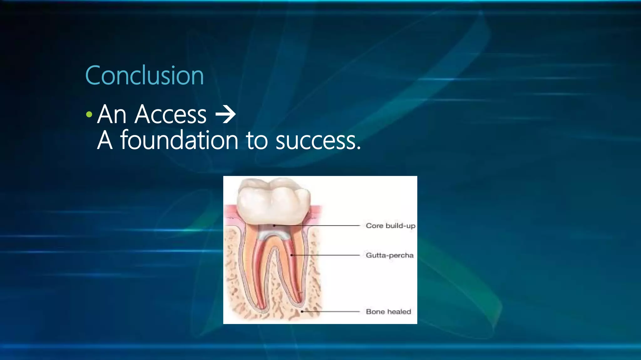 Endodontic Access Cavity Preparation | PPTX