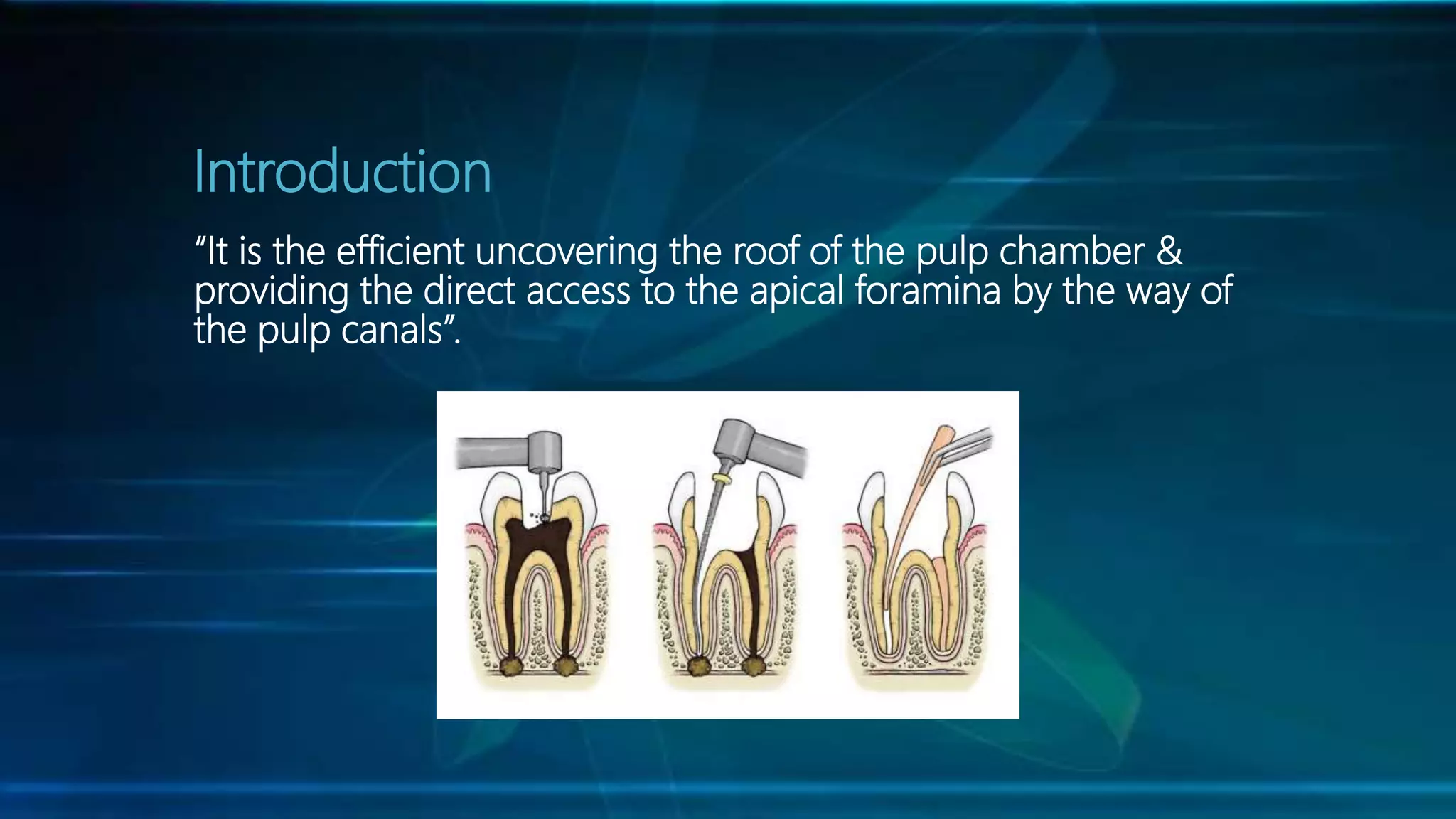 Endodontic Access Cavity Preparation | PPTX