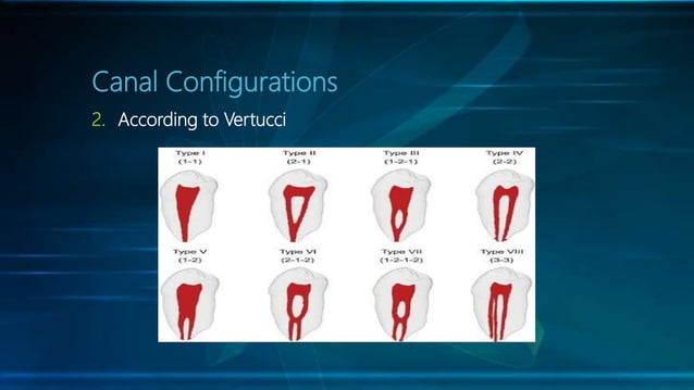 Endodontic Access Cavity Preparation | PPTX