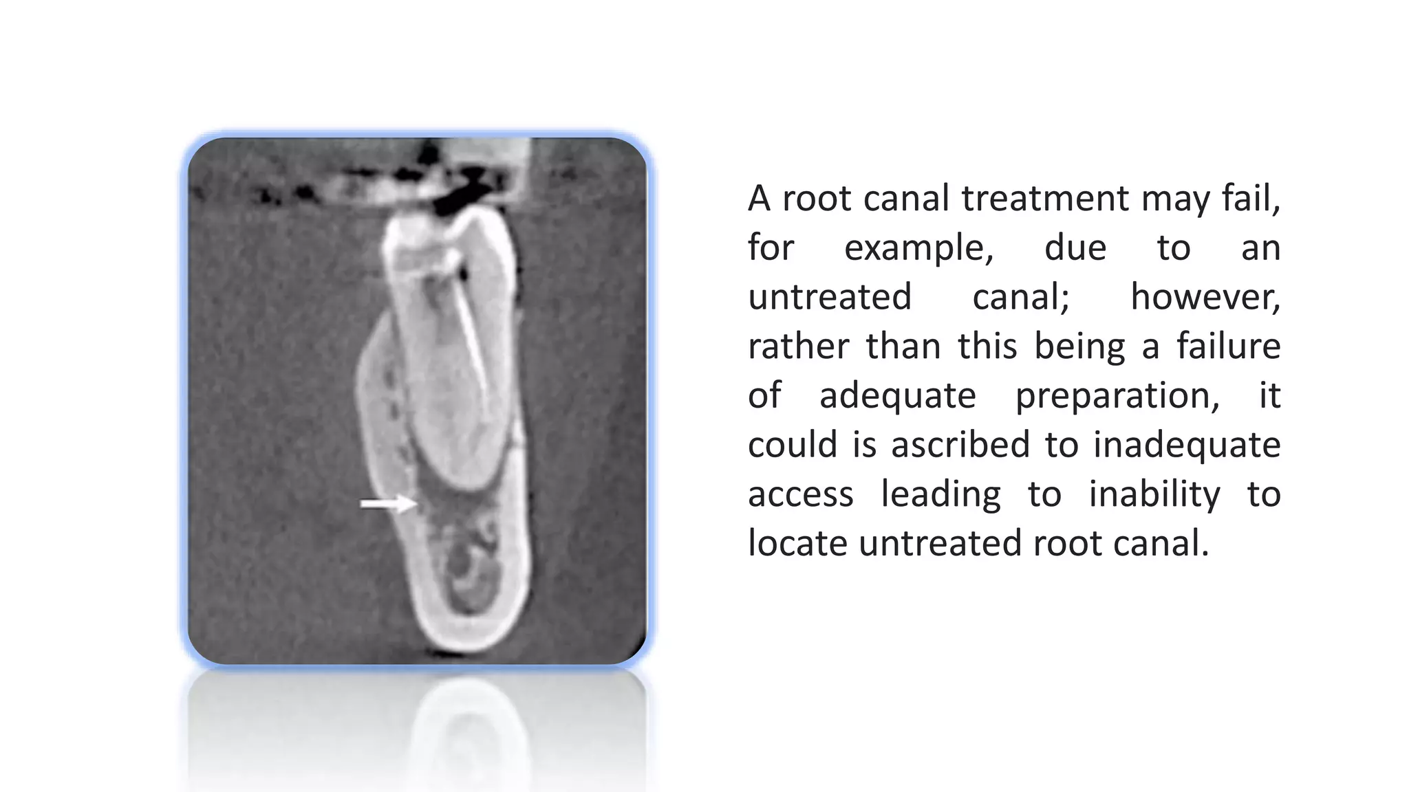 Endodontic Access Cavity.pptx