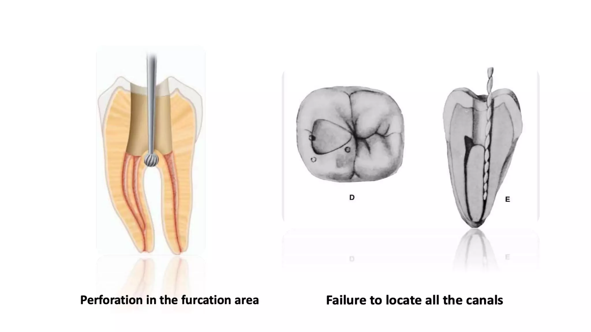 Endodontic Access Cavity.pptx