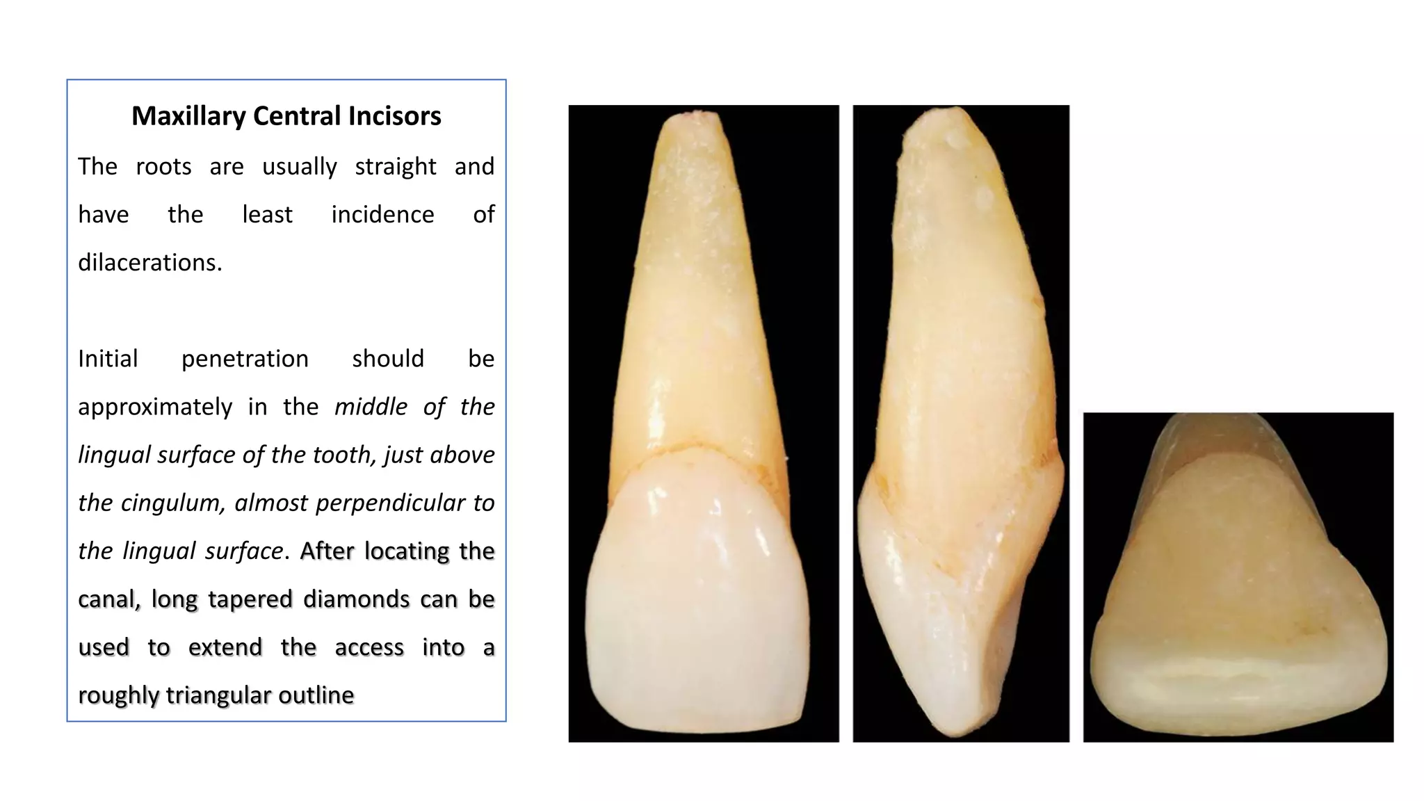Endodontic Access Cavity.pptx