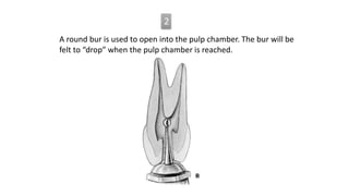 Endodontic Access Cavity.pptx