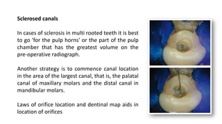 Endodontic Access Cavity.pptx