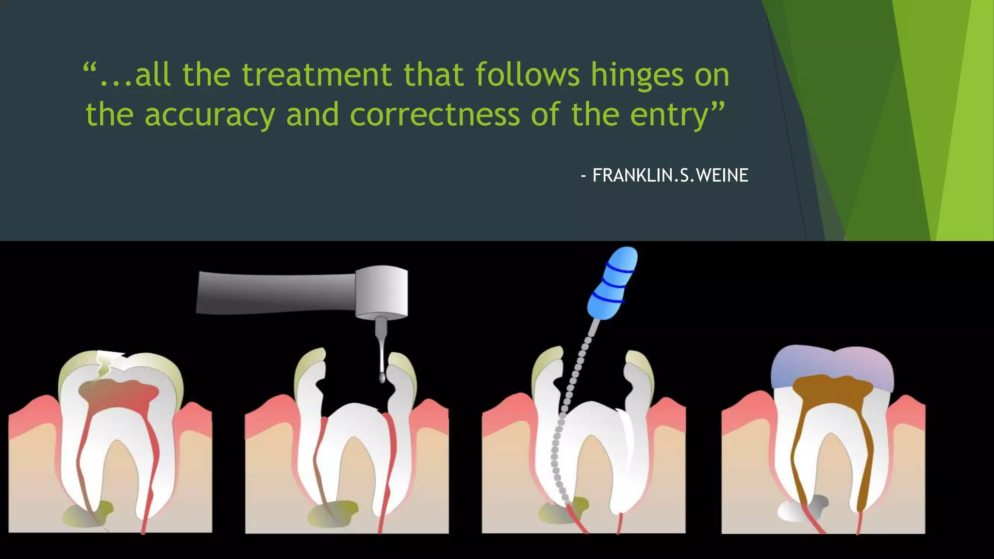 Endodontic Access Cavity Preparation | PPTX