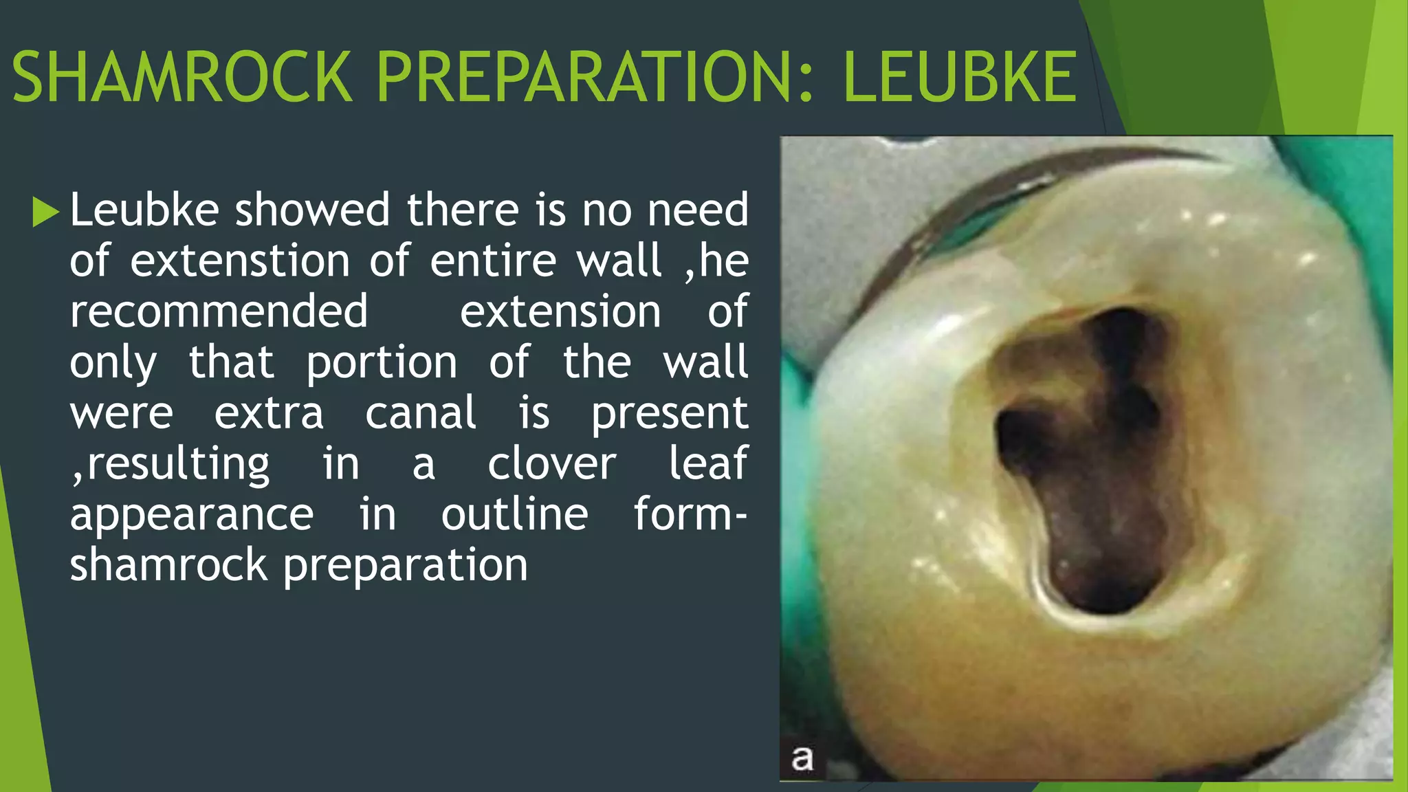 Endodontic Access Cavity Preparation | PPTX