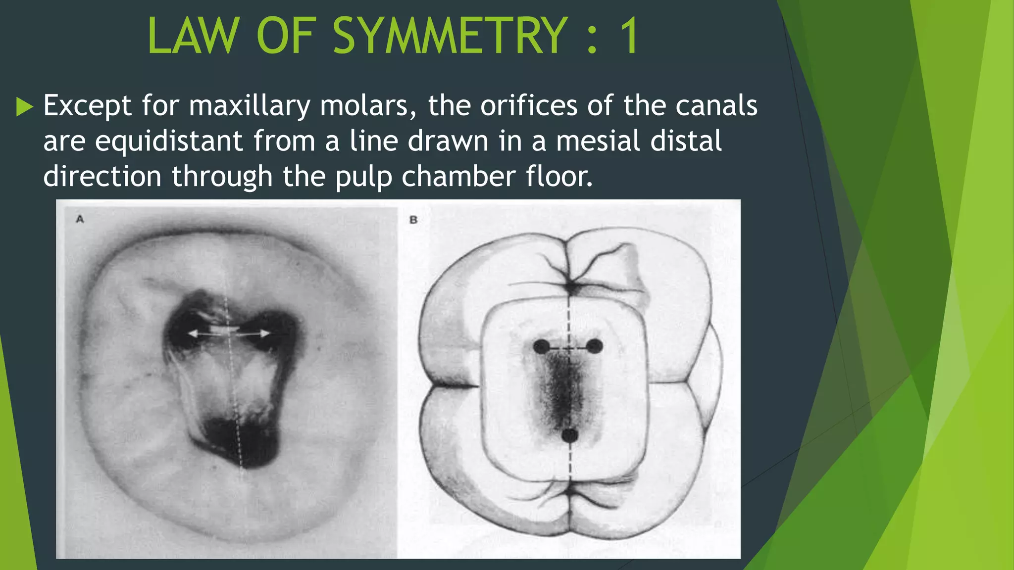 Endodontic Access Cavity Preparation | PPTX