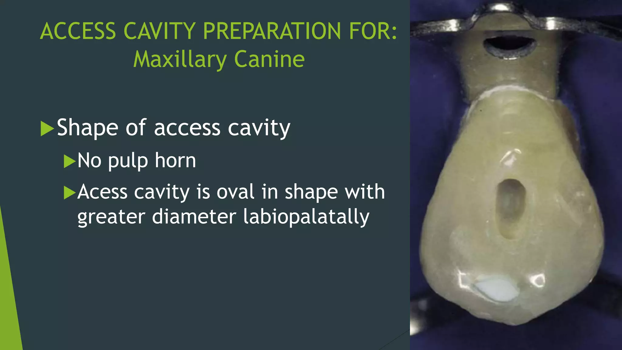 Endodontic Access Cavity Preparation | PPTX