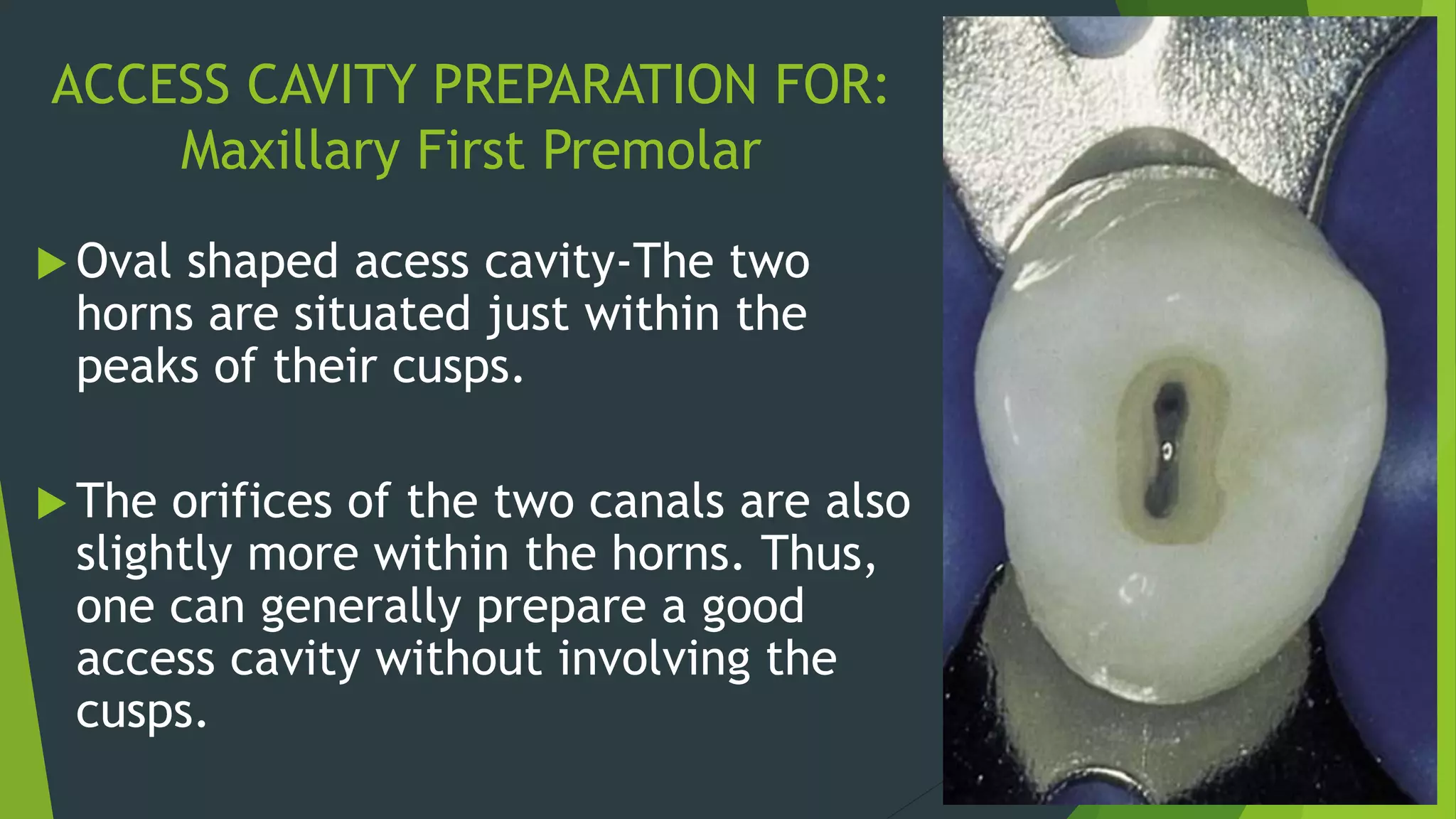 Endodontic Access Cavity Preparation | PPTX