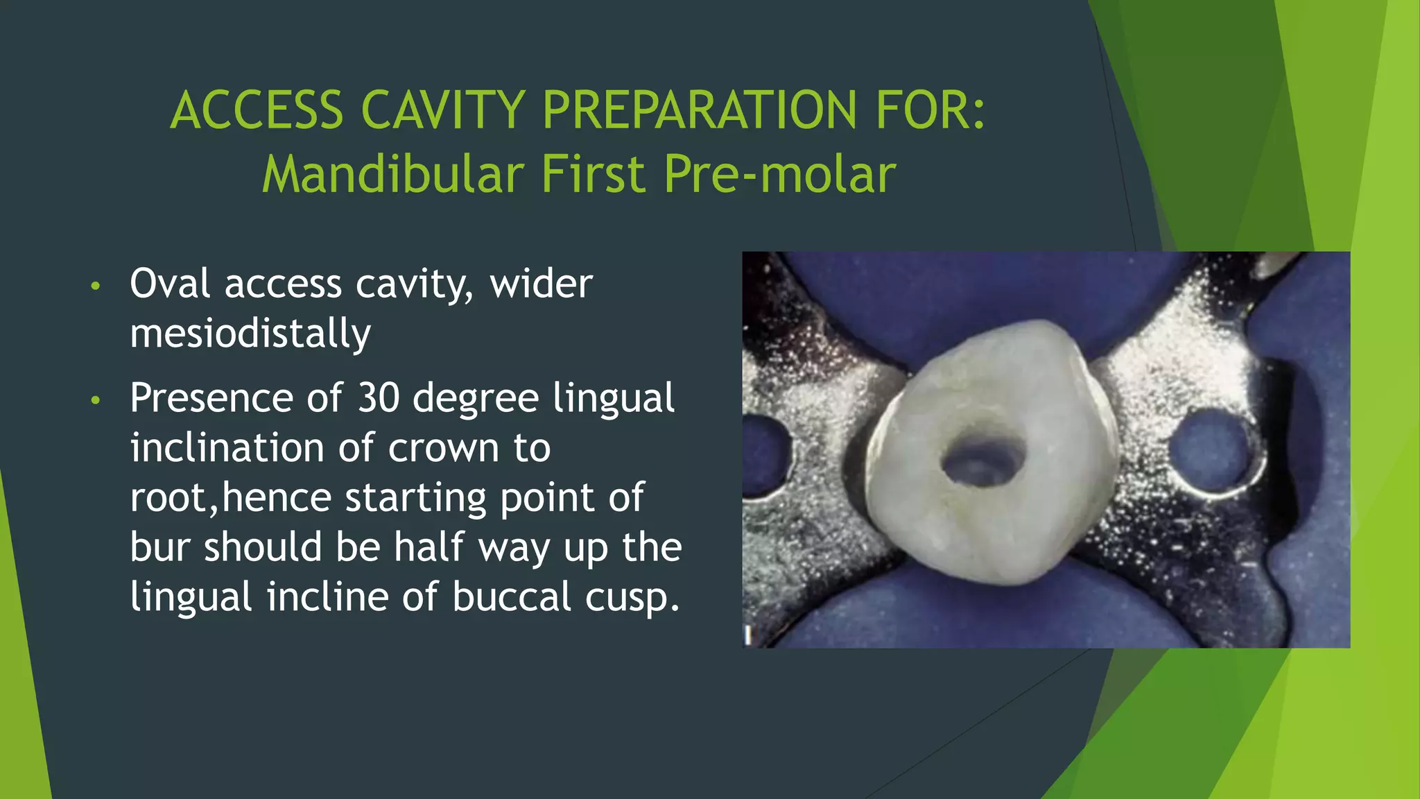 Endodontic Access Cavity Preparation | PPTX