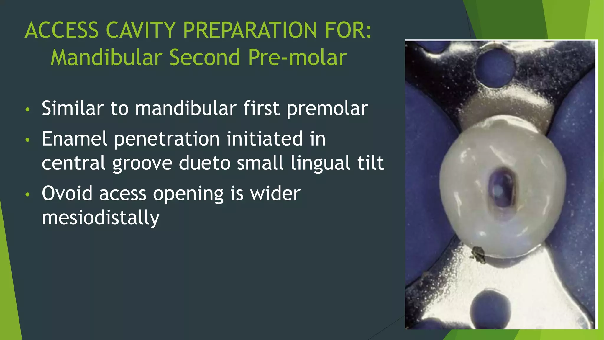 Endodontic Access Cavity Preparation | PPTX