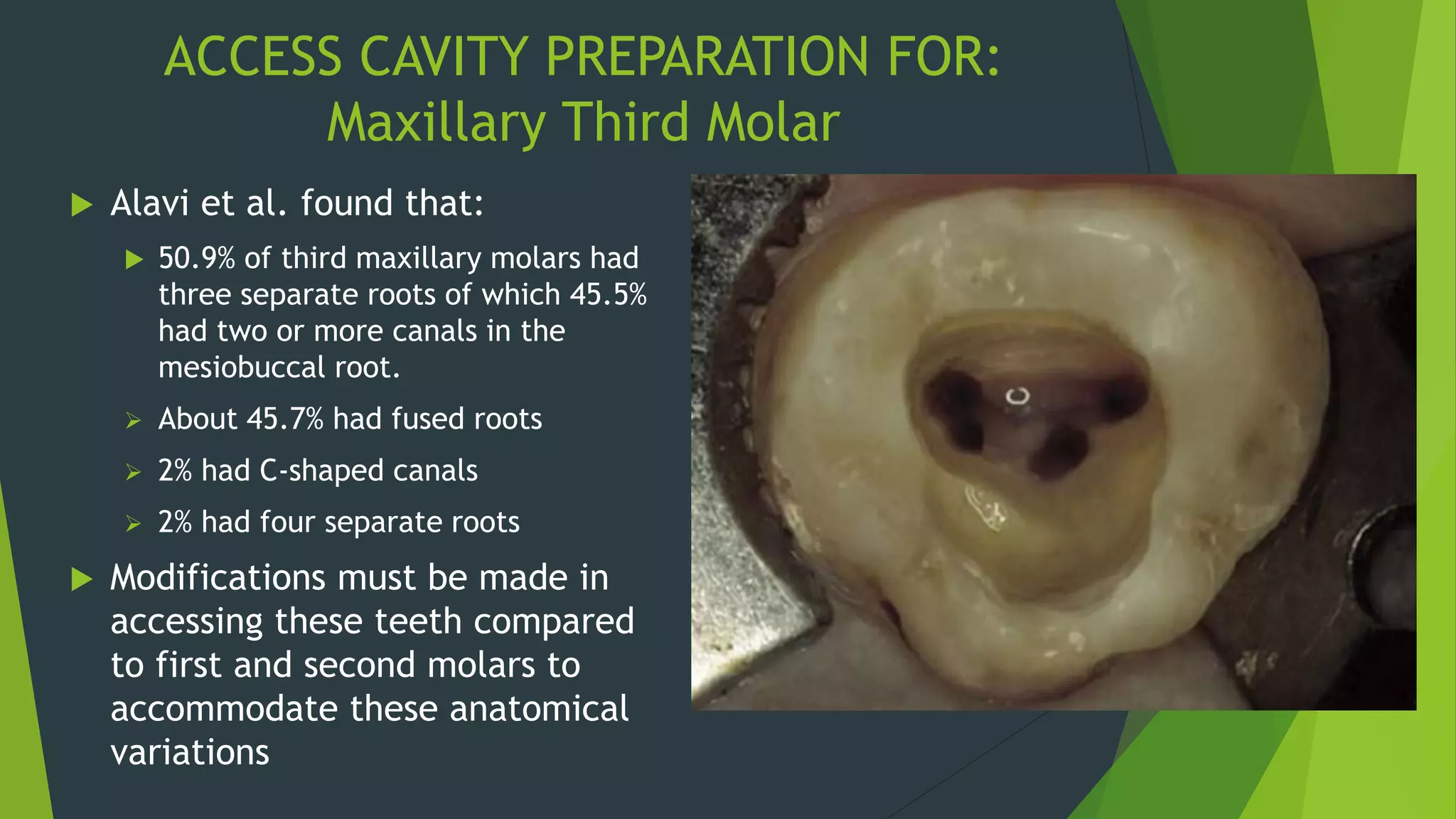 Endodontic Access Cavity Preparation | PPTX