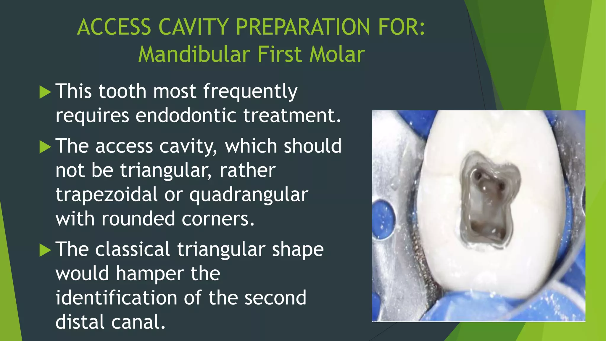 Endodontic Access Cavity Preparation | PPTX