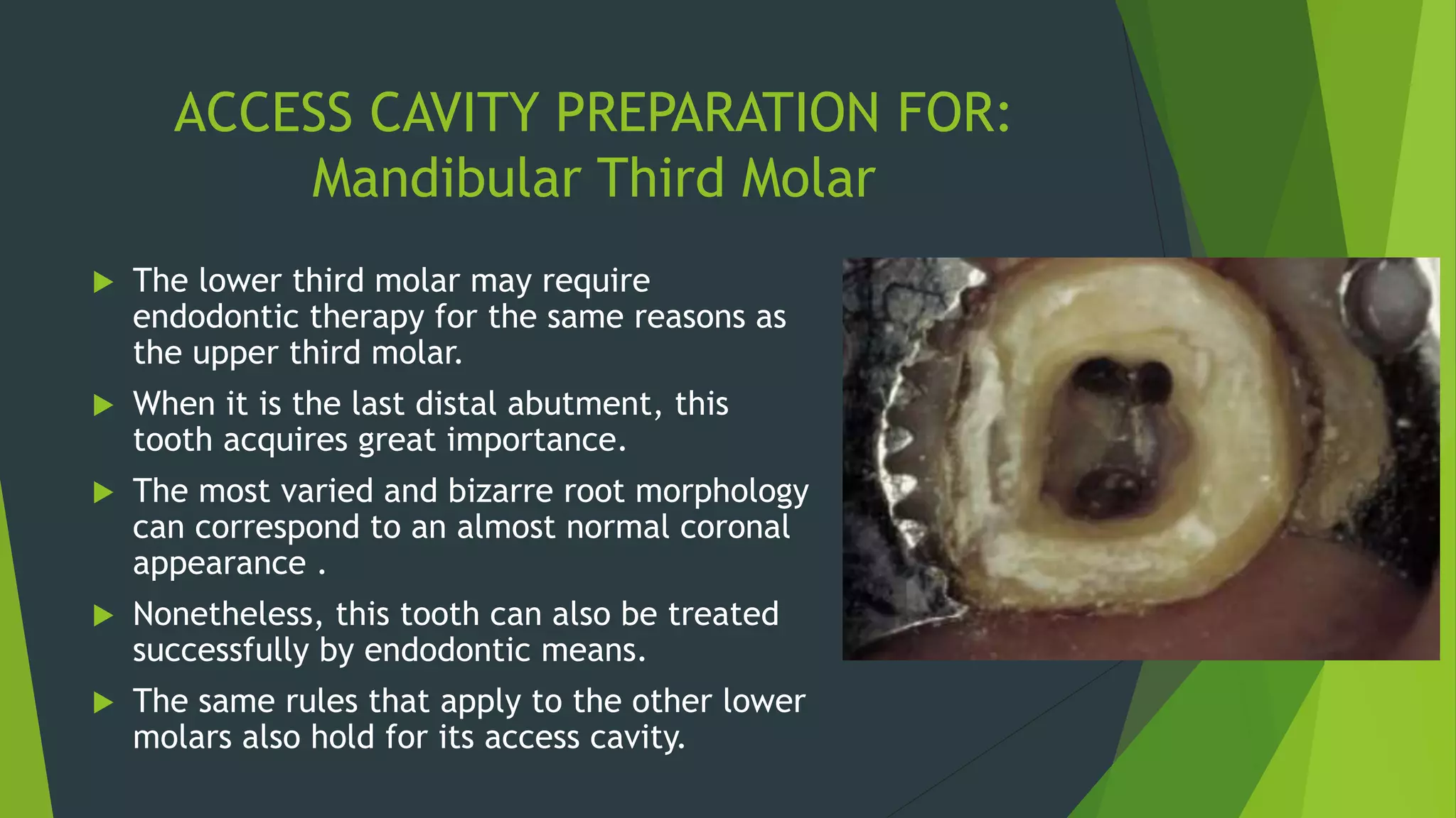 Endodontic Access Cavity Preparation | PPTX