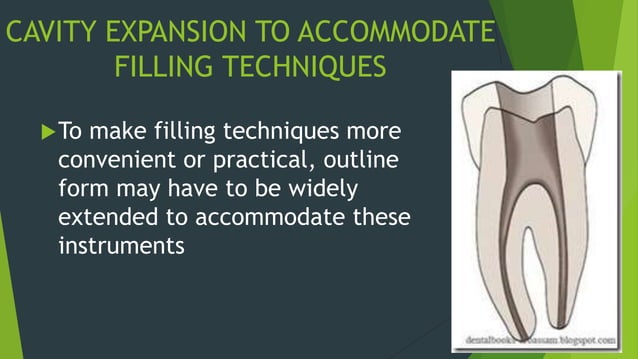 Endodontic Access Cavity Preparation | PPTX
