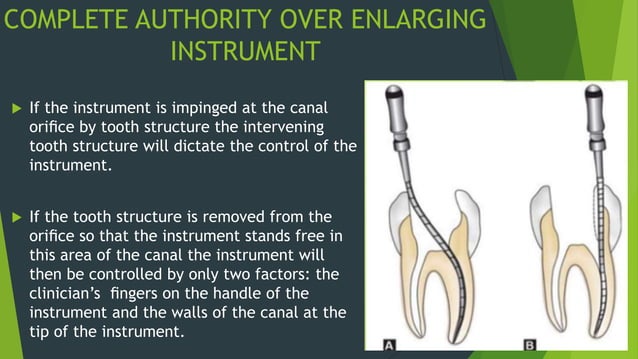 Endodontic Access Cavity Preparation | PPTX