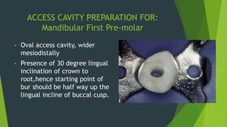 Endodontic Access Cavity Preparation | PPTX
