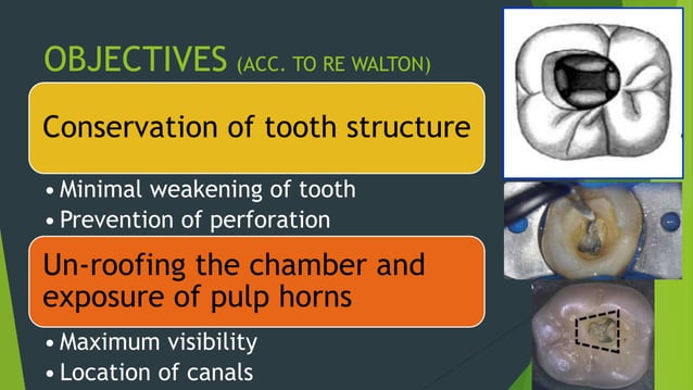 Endodontic Access Cavity Preparation | PPTX