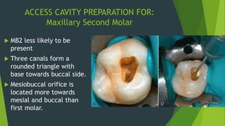Endodontic Access Cavity Preparation | PPTX
