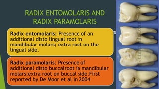 Endodontic Access Cavity Preparation | PPTX