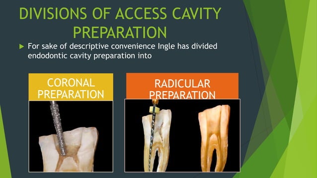 Endodontic Access Cavity Preparation