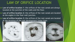 Endodontic Access Cavity Preparation | PPT