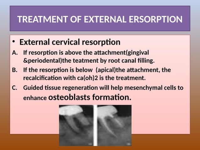 ENDODONTIC ASPECT ROOT RESORPTION dental.pptx