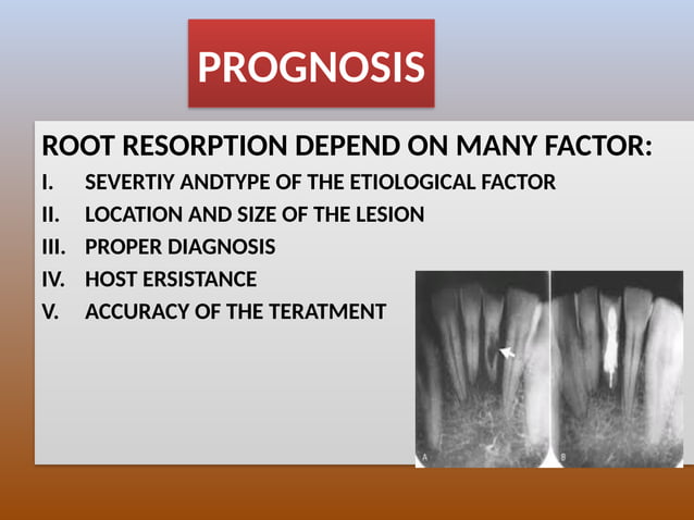 ENDODONTIC ASPECT ROOT RESORPTION dental.pptx