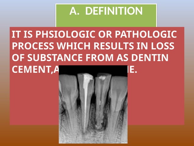 ENDODONTIC ASPECT ROOT RESORPTION dental.pptx